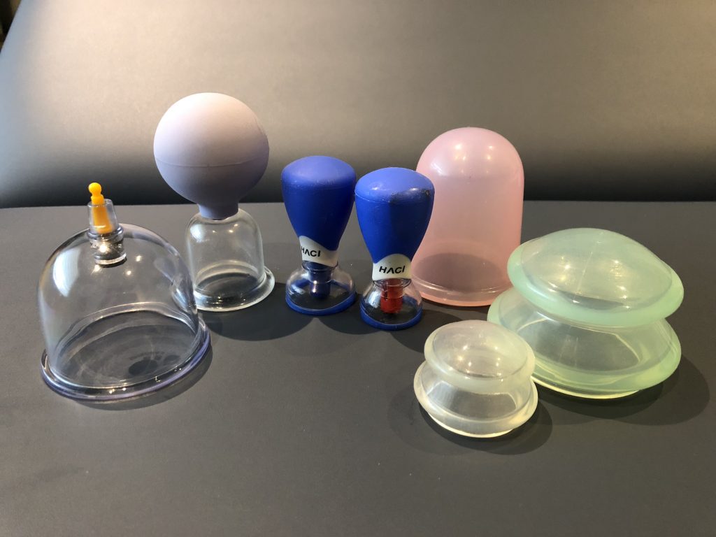 Les ventouses, c’est quoi au juste et qu’est-ce que ça fait ...